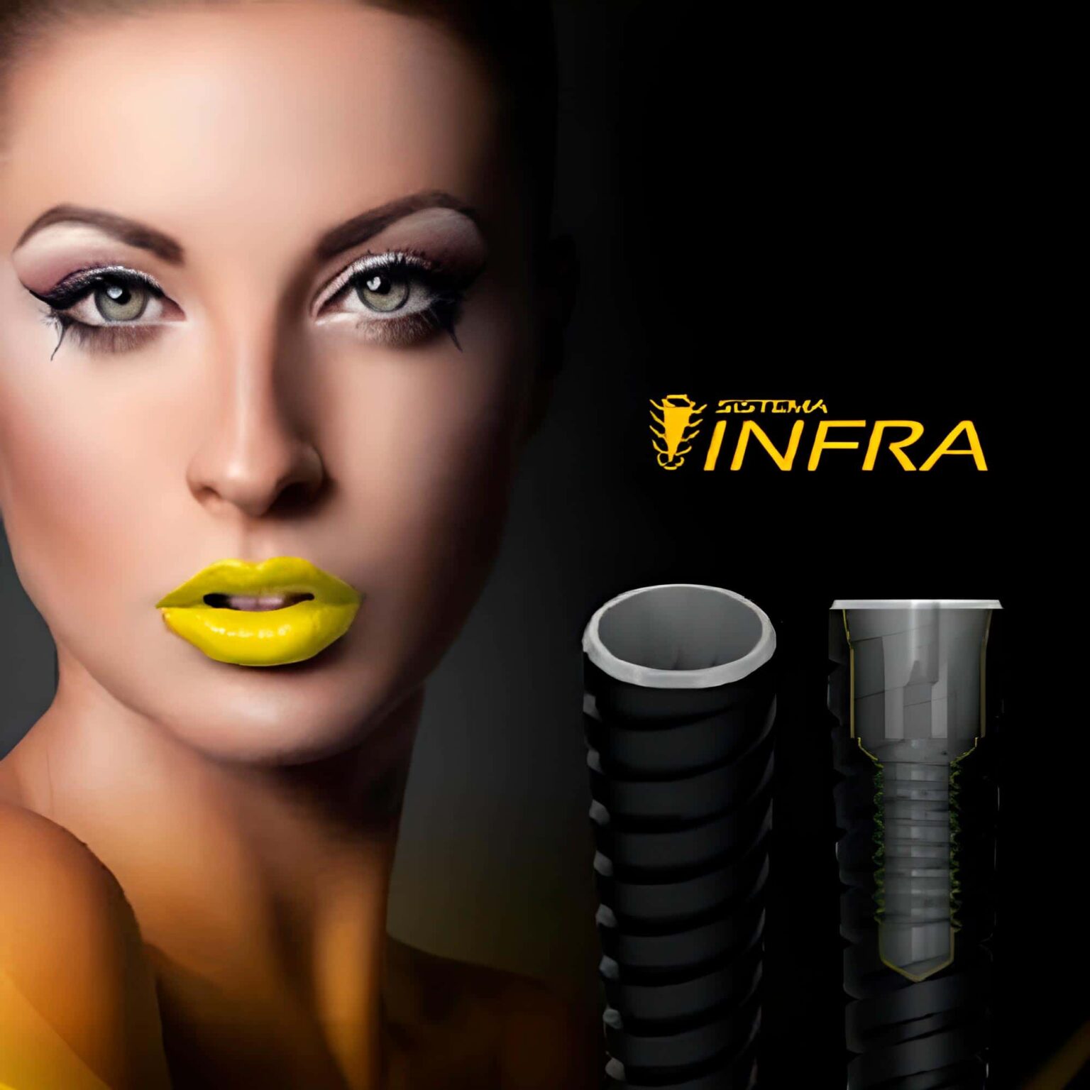 Implante Infra - Fulldent Ltda.